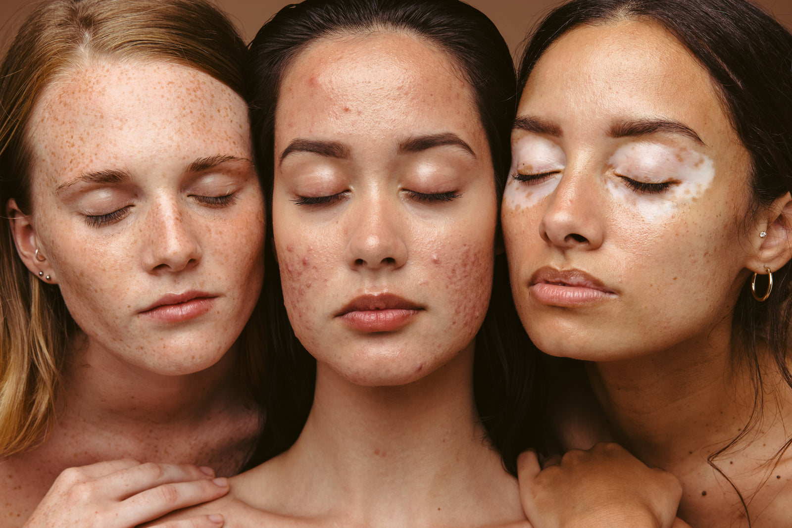 Rockwall Med Spa & Skincare | Freckled Skin studio
